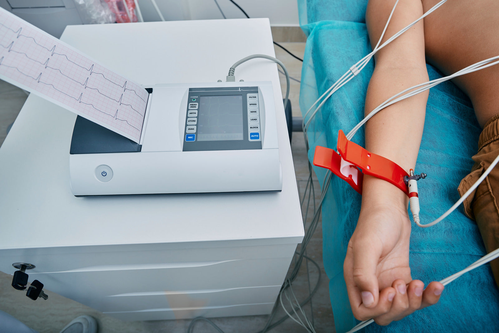 Advantages of Using a Mortara ECG Machine for Medical Practices